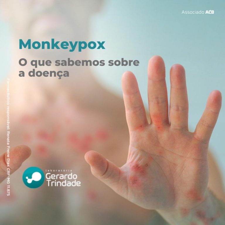 O que é Monkeypox? – Laboratório Gerardo Trindade